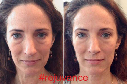 REJUVANCE - Κέντρο Ολιστικής Ιατρικής Θεσπρωτίας